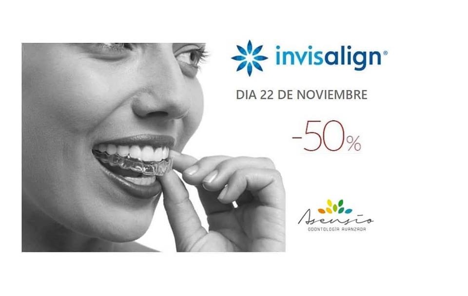 Promocion Invisalign - Dental Asensio, tu Clínica dental en Valencia ...